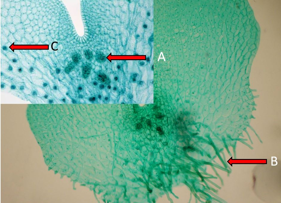 Solved \ The body of the specimen is called | Chegg.com
