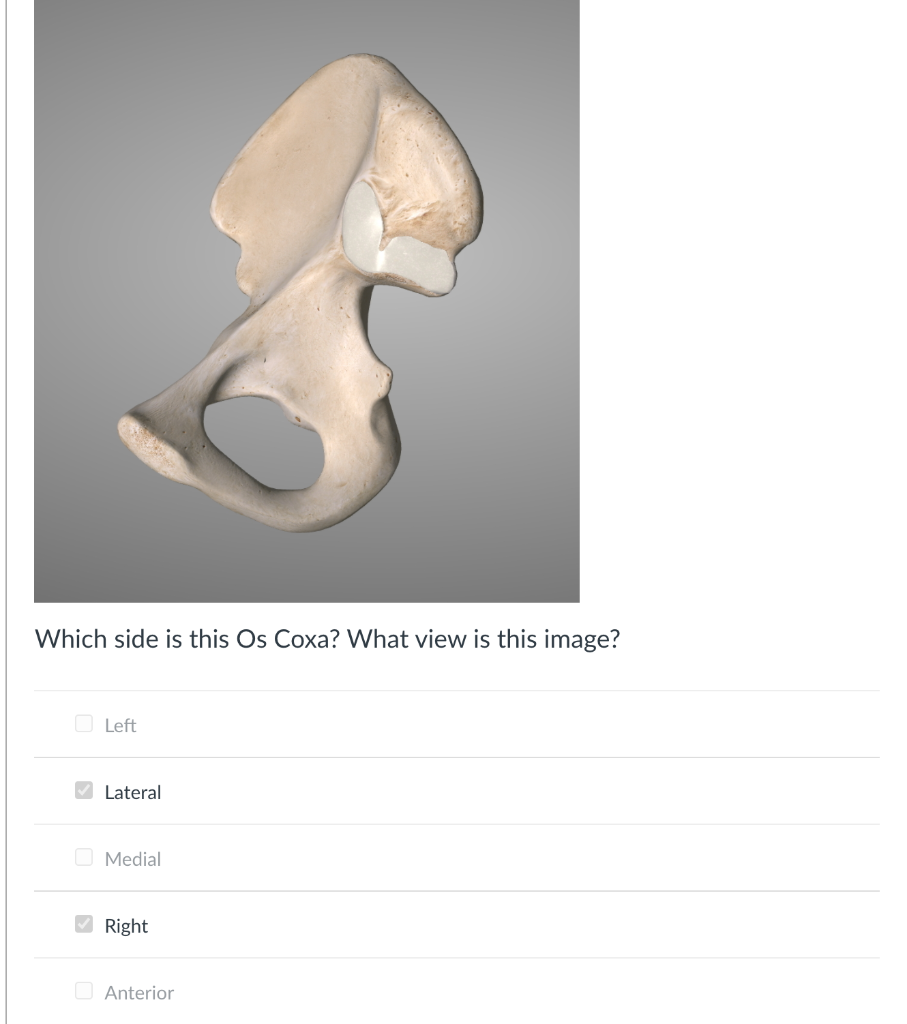 Solved Which side is this Os Coxa? What view is this image? | Chegg.com