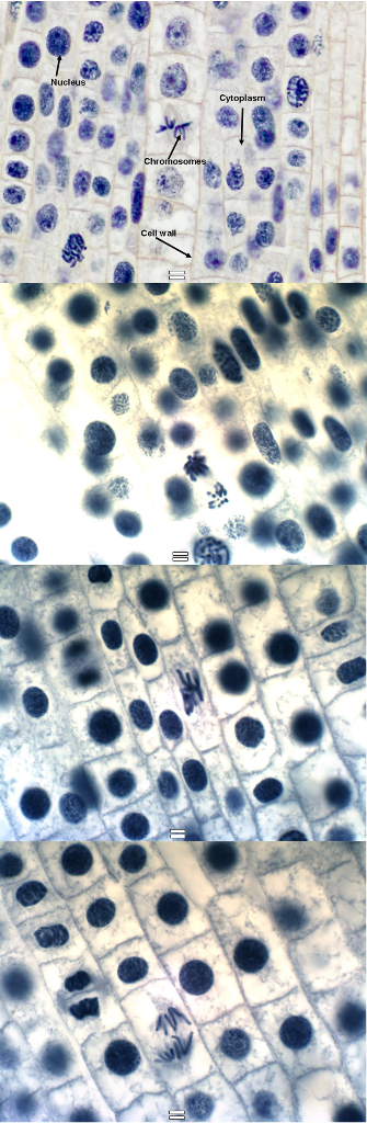 Solved Experiment 1: Observation of Mitosis in a Plant | Chegg.com