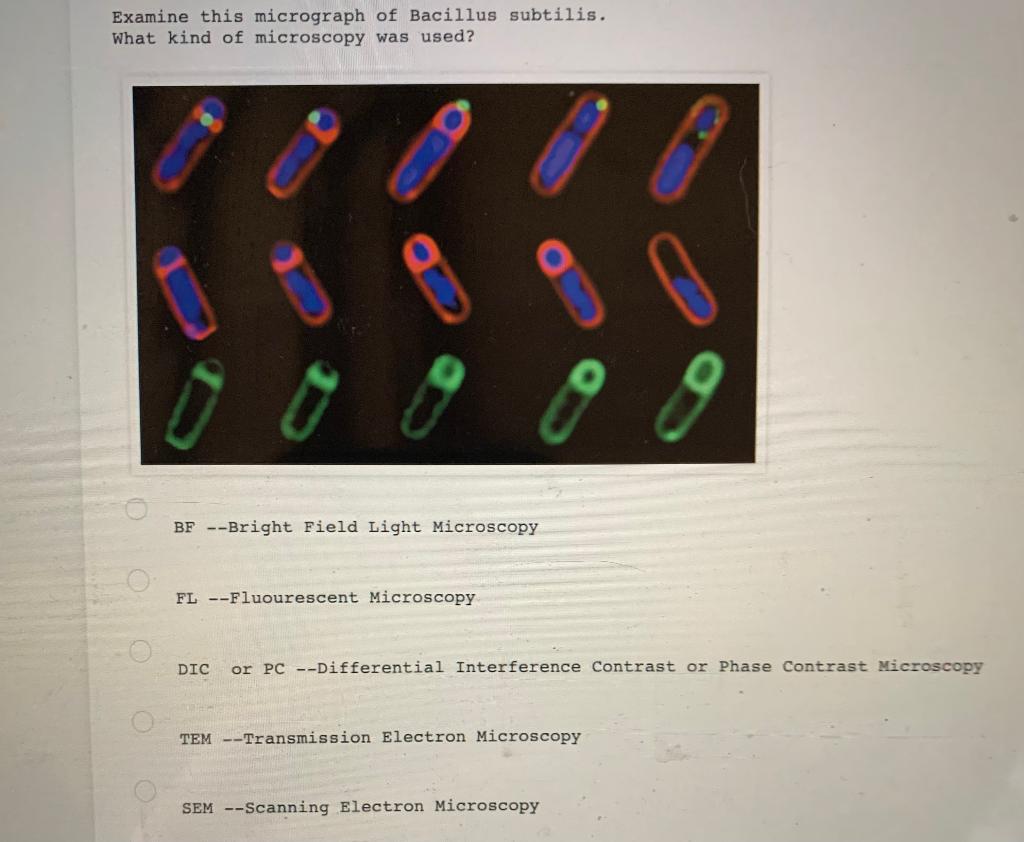 Solved Examine this micrograph examining the synapse between | Chegg.com