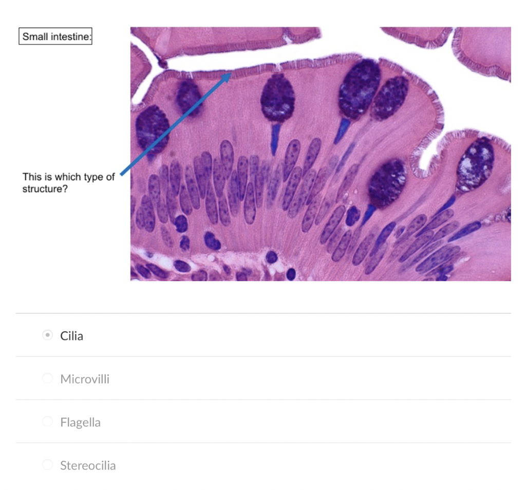 Solved Urinary bladder:) This cell is part of: Endothelium | Chegg.com