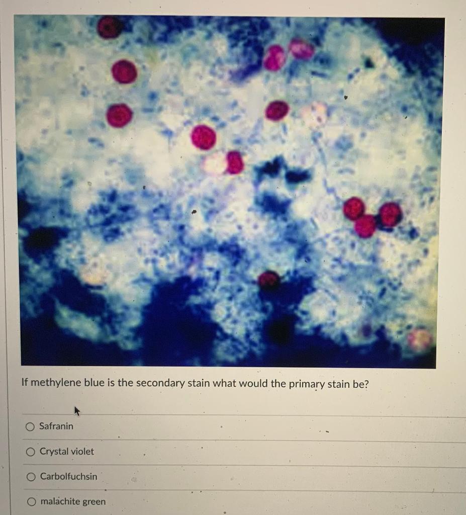 Solved If methylene blue is the secondary stain what would | Chegg.com
