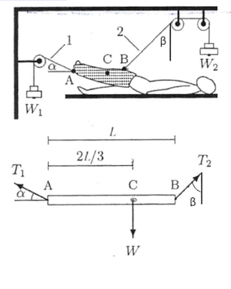 Solved A split Russell traction device (shown below) is used | Chegg.com