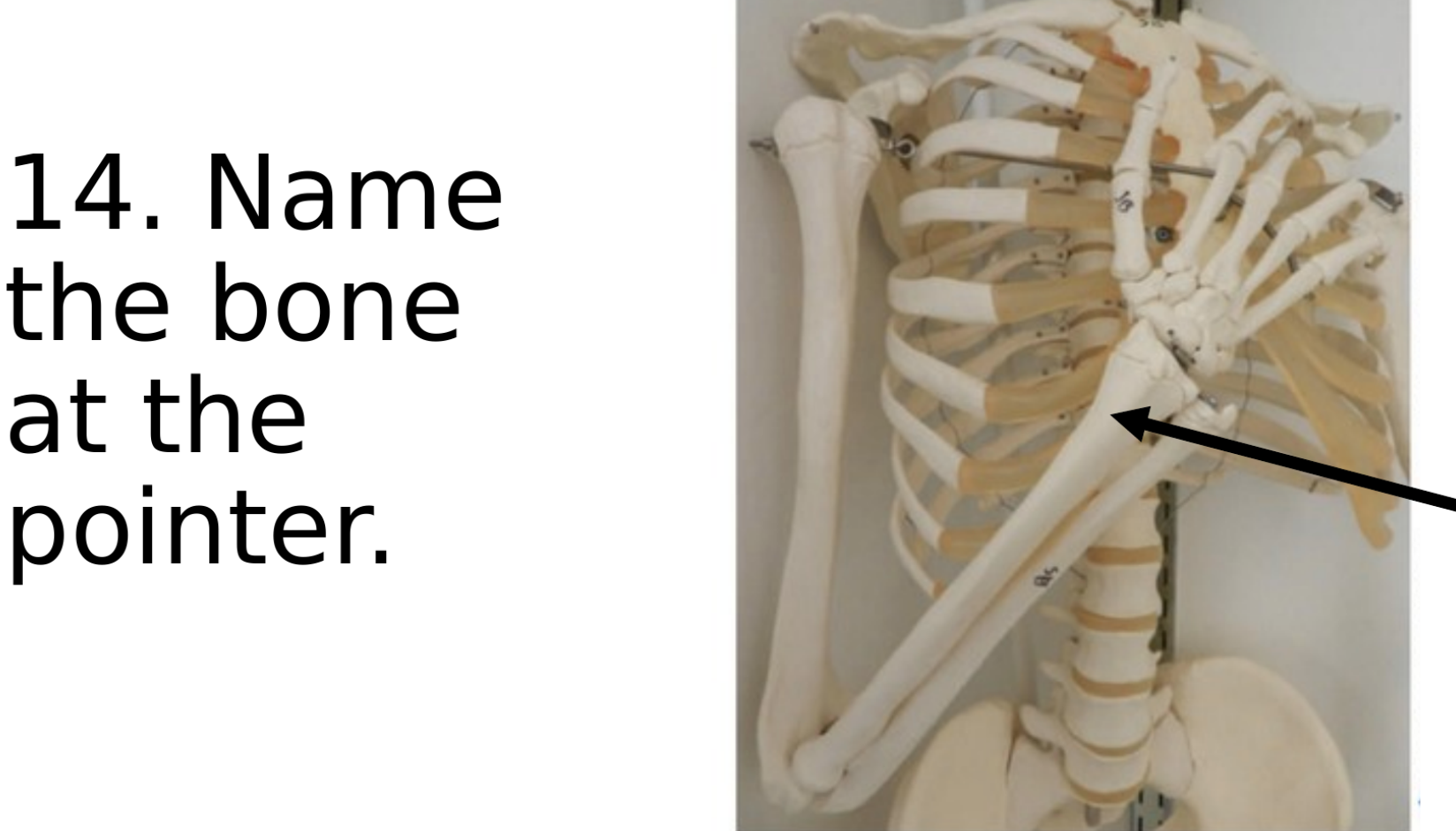 Solved 14. Name the bone at the pointer. | Chegg.com