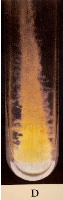 Solved The bacterial growth pattern on agar slant Tube D is | Chegg.com
