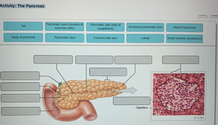 Solved Activity: The Pancreas Pancreatic acini (clusters | Chegg.com