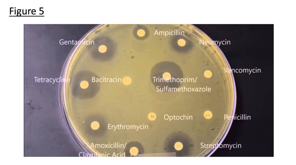 Solved 19. You plated the bacteria on Mannitol salt agar and | Chegg.com