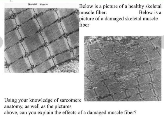 Solved Skeletal Muscle Below is a picture of a healthy | Chegg.com