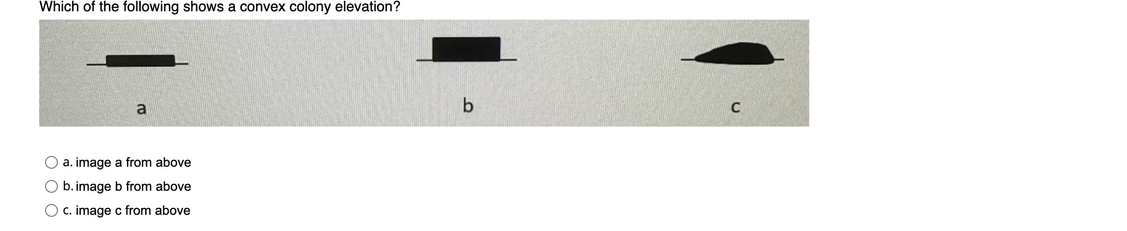 Solved Which of the following shows a convex colony | Chegg.com
