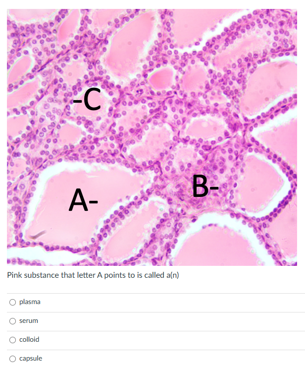 Solved Cells found in structure indicated by letter A | Chegg.com