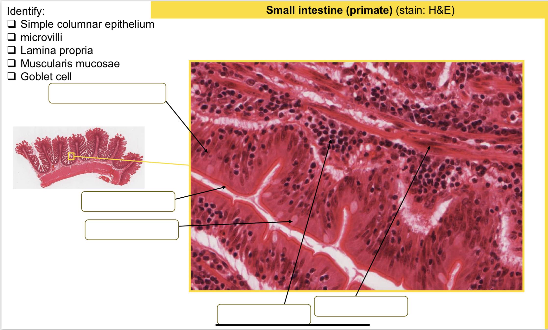 Solved Large intestine (human) (stain: H\&E)Small intestine | Chegg.com