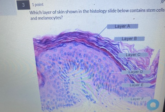 Solved Which layer of skin shown in the histology slide | Chegg.com