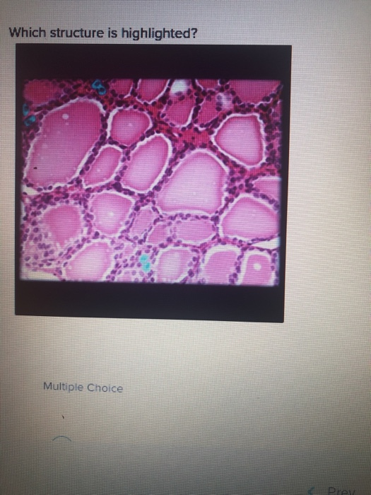 Solved Which structure is highlighted? Multiple Choice Prey | Chegg.com