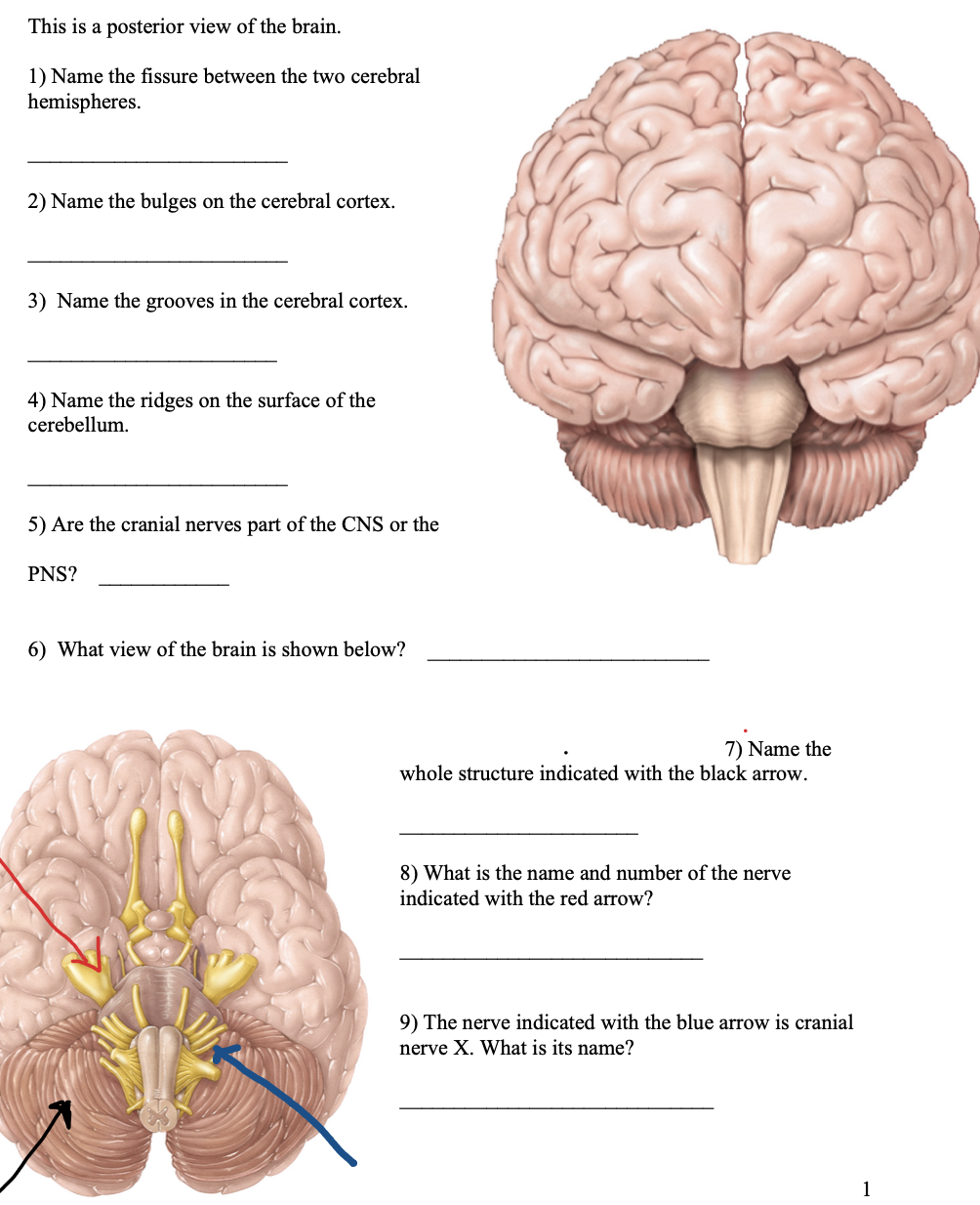 Solved This is a posterior view of the brain. 1) Name the | Chegg.com