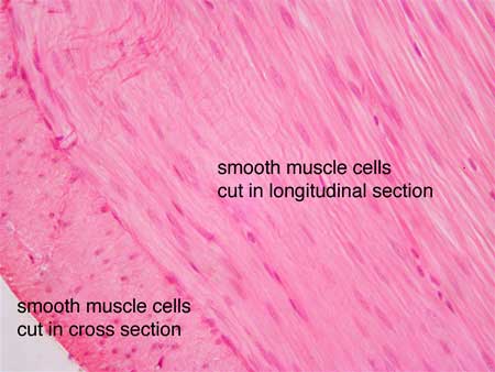Solved Skeletal Muscle Cells Drawing Label: nuclei and | Chegg.com
