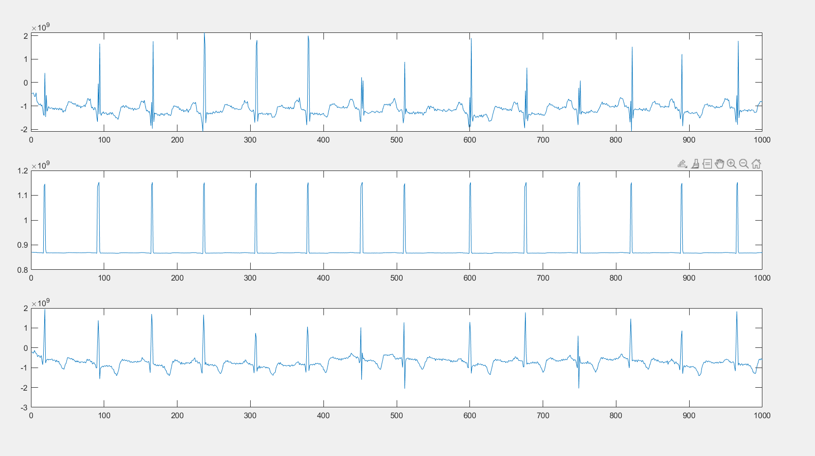 ECG signal I. II. Write a Matlab program to generate | Chegg.com