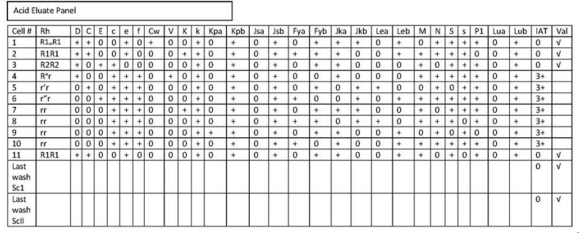Blood Banking Question. What do the result of the gel | Chegg.com