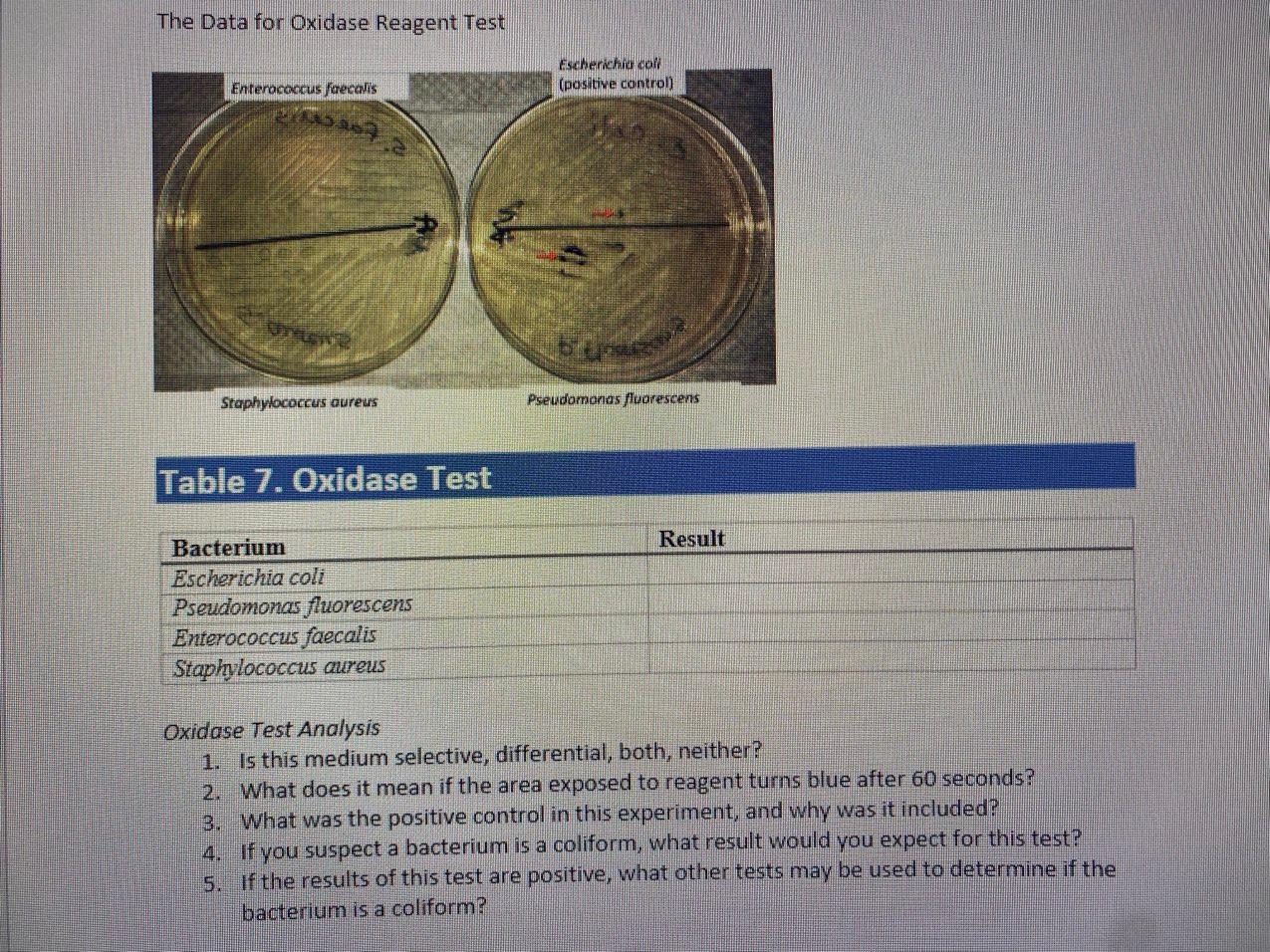 Solved The Data for Oxidase Reagent Test Escherichia coli | Chegg.com