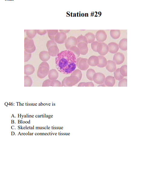 Solved Station | Chegg.com