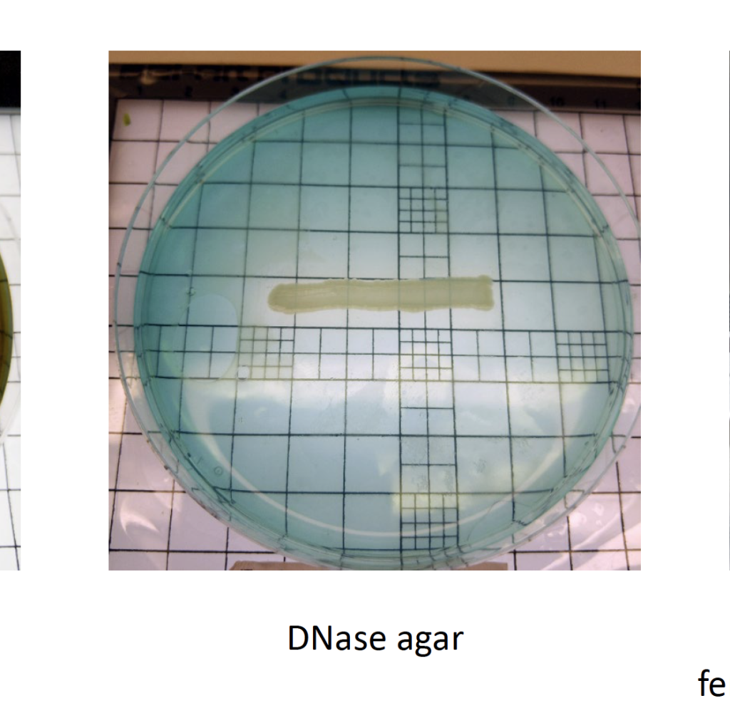 Solved DNase agar fe | Chegg.com