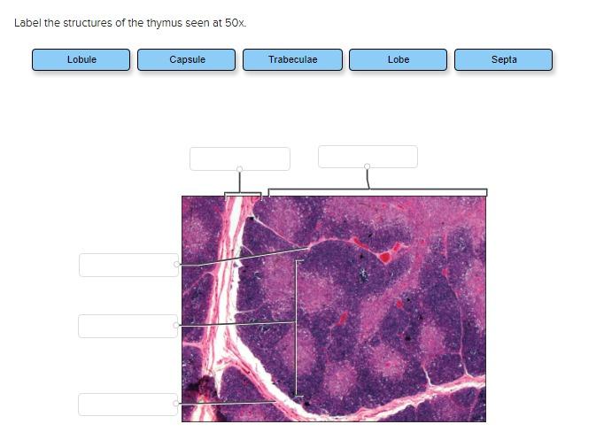 Solved Label the structures of the thymus seen at 50x. | Chegg.com
