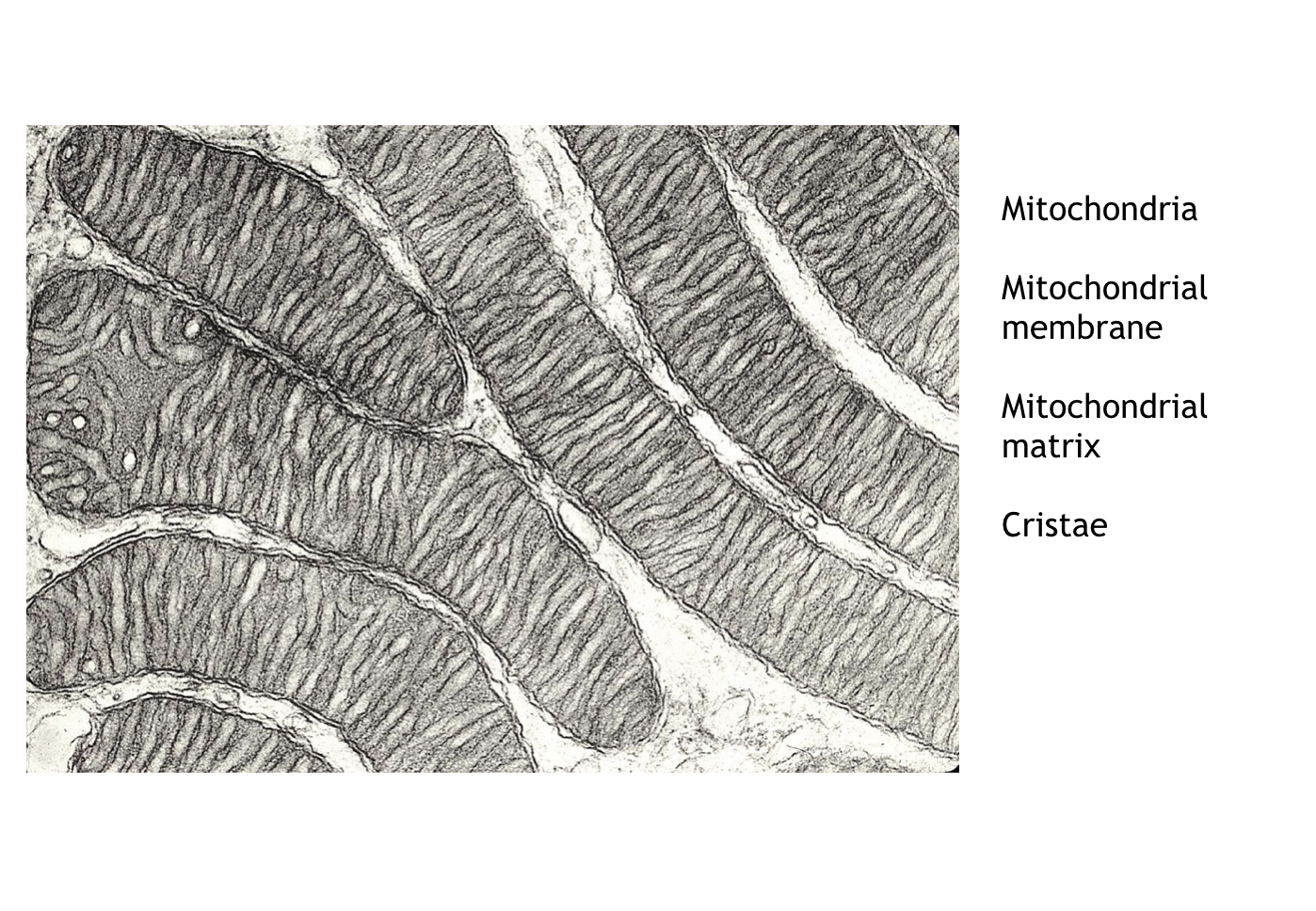 Solved Identify structures in the EM micrographs Match the | Chegg.com