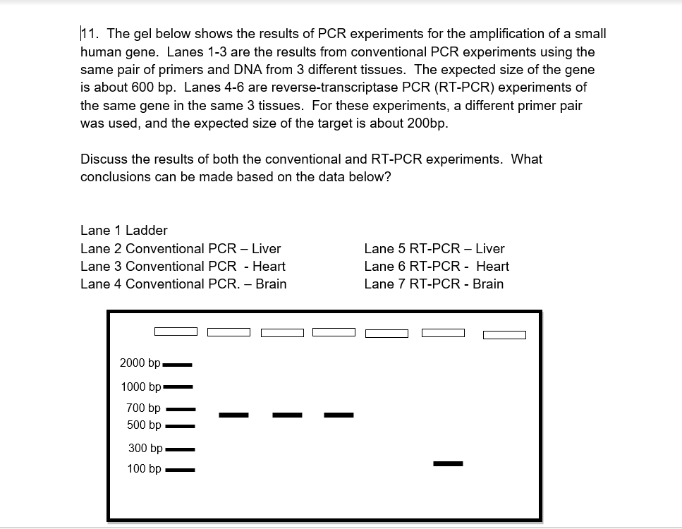 Solved 11. The gel below shows the results of PCR | Chegg.com