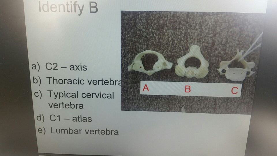 Solved Identify a) C2- axis b) Thoracic vertebra c) | Chegg.com