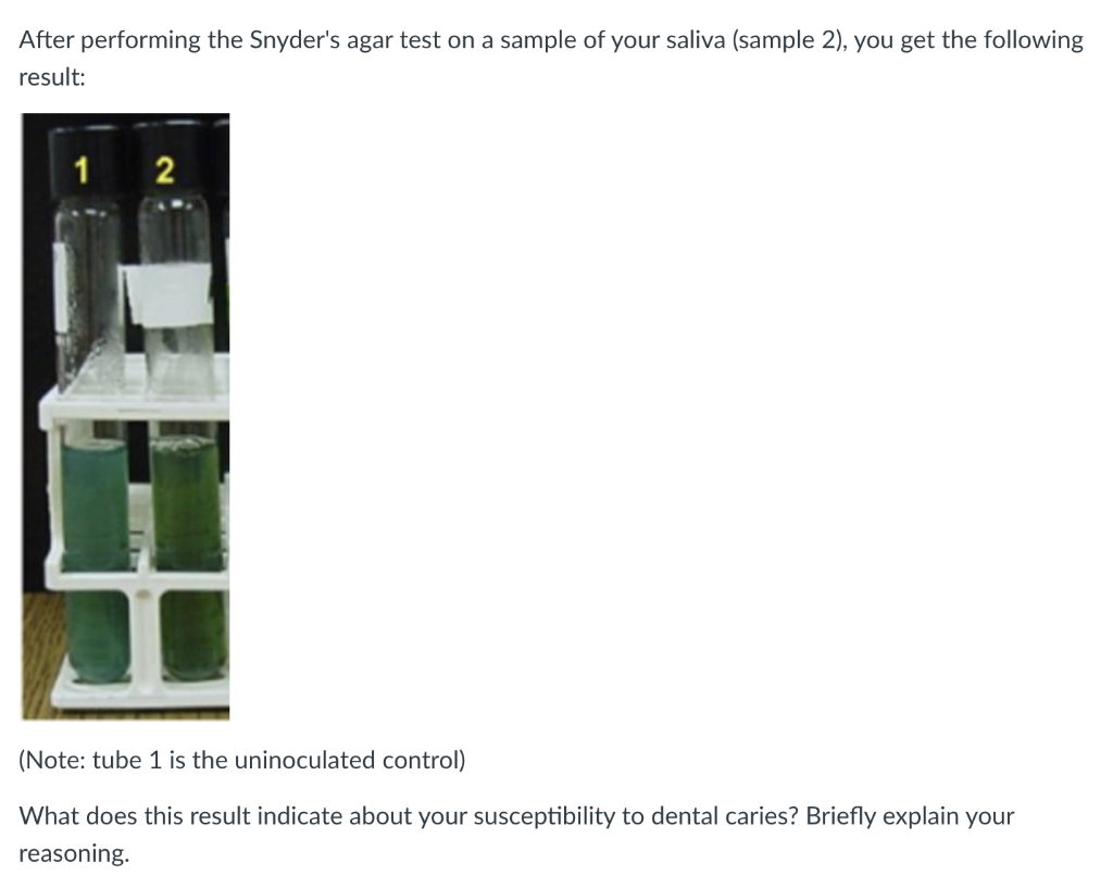 Solved After performing the Snyder's agar test on a sample | Chegg.com