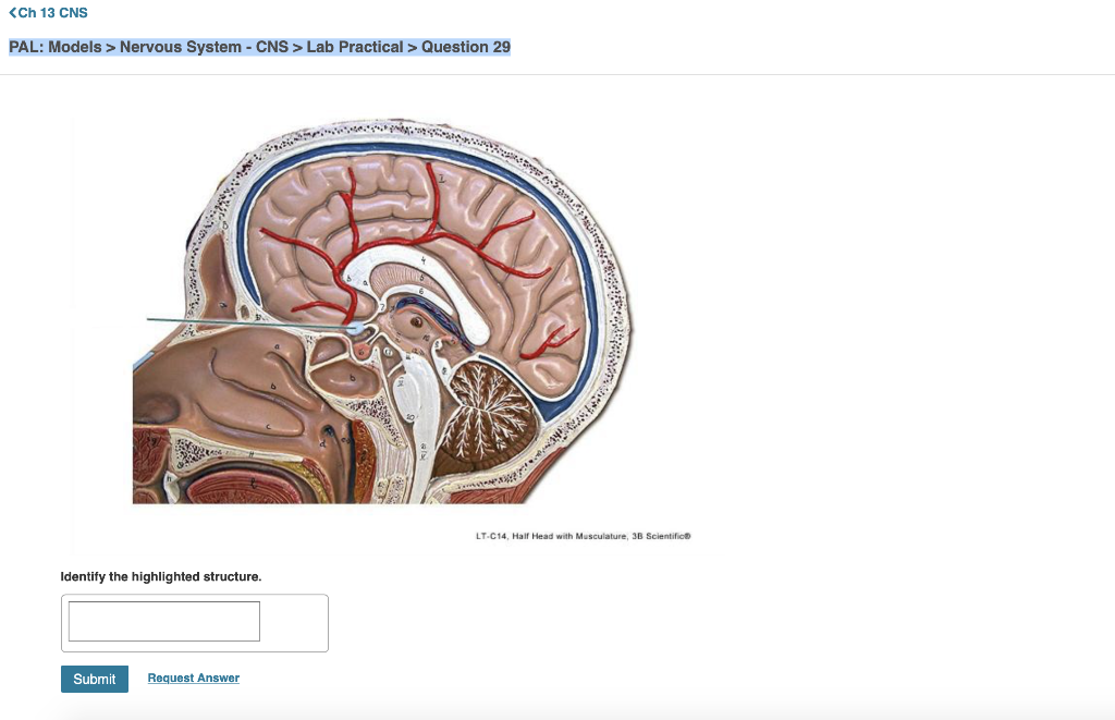 Solved PAL: Models > Nervous System - CNS > Lab Practical | Chegg.com Solved PAL: Models > Nervous System - CNS > Lab Practical | Chegg.com