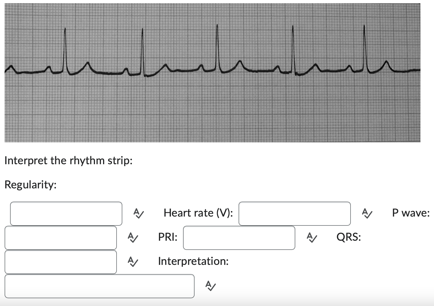 Solved Interpret the rhythm strip:Regularity:Heart rate | Chegg.com