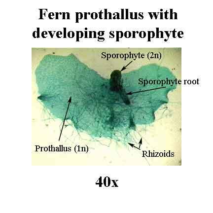 Fern Sporophyte Microscope