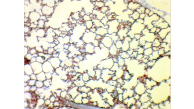 Solved From the Lung (simple squamous): Recognize slide at | Chegg.com