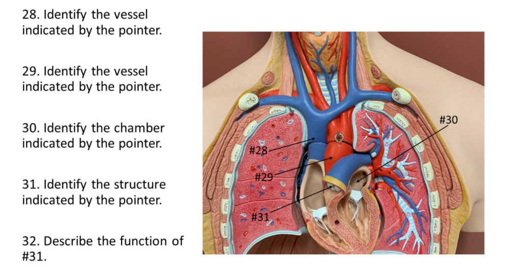 Solved 28. Identify the vessel indicated by the pointer. 29. | Chegg.com