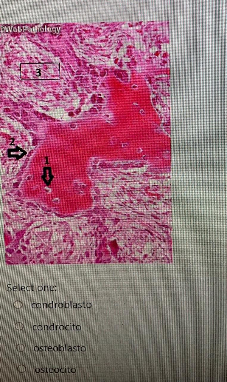 Solved WebPathology Select one: O condroblasto O condrocito | Chegg.com