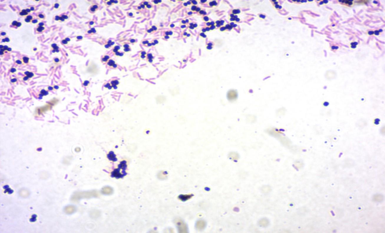 Solved Biochemical Test results Gram positive or gram | Chegg.com