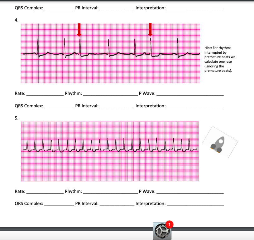 Solved Rate: Rhythm: P Wave: QRS Complex: PR Interval: | Chegg.com