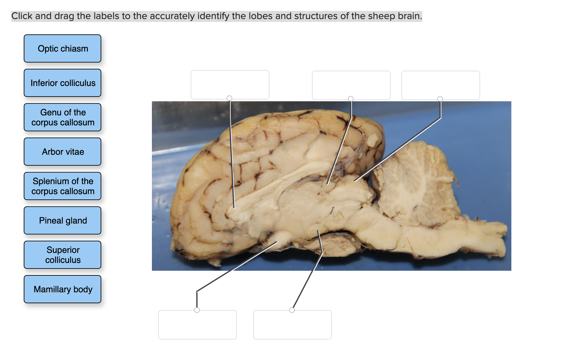 Solved Click and drag the labels to the accurately identify | Chegg.com