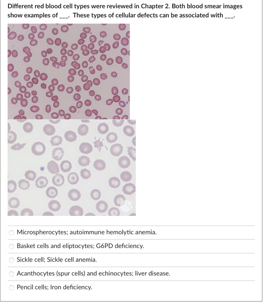 Solved Different red blood cell types were reviewed in | Chegg.com