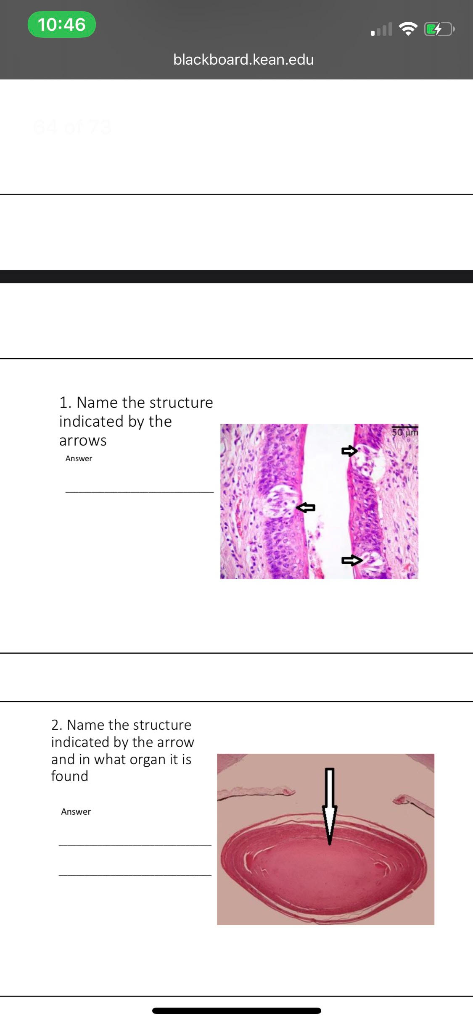 Solved 10:46 blackboard.kean.edu 1. Name the structure | Chegg.com