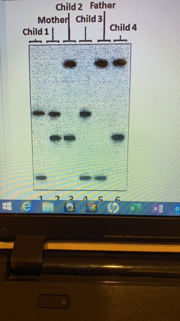 Solved 1 2 3 4 5 6 Results from a single locus, probe DNA | Chegg.com
