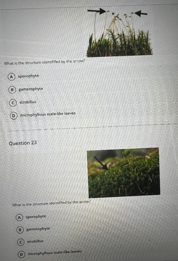 Solved What is the structure identififed by the arrow? A | Chegg.com