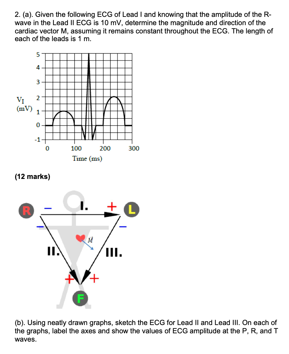 2. (a). Given the following ECG of Lead I and knowing | Chegg.com