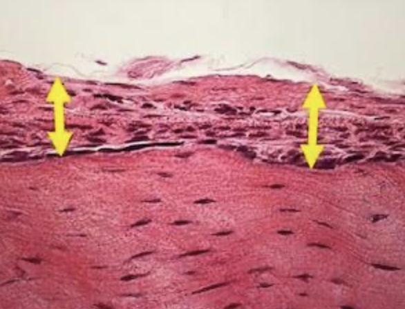 Solved identify tissue indicated by double arrows a. outer | Chegg.com