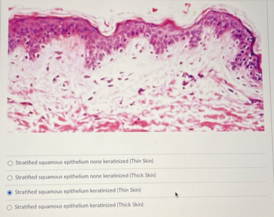 Stratified Squamous Epithelium Keratinized Skin