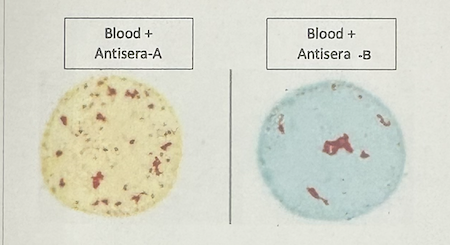 Based on the following blood type results, what blood | Chegg.com