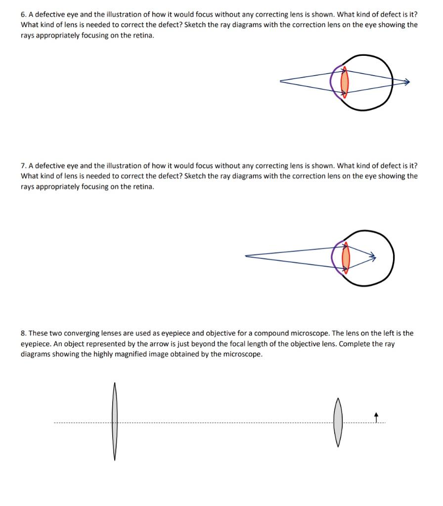 Solved 6. A defective eye and the illustration of how it | Chegg.com