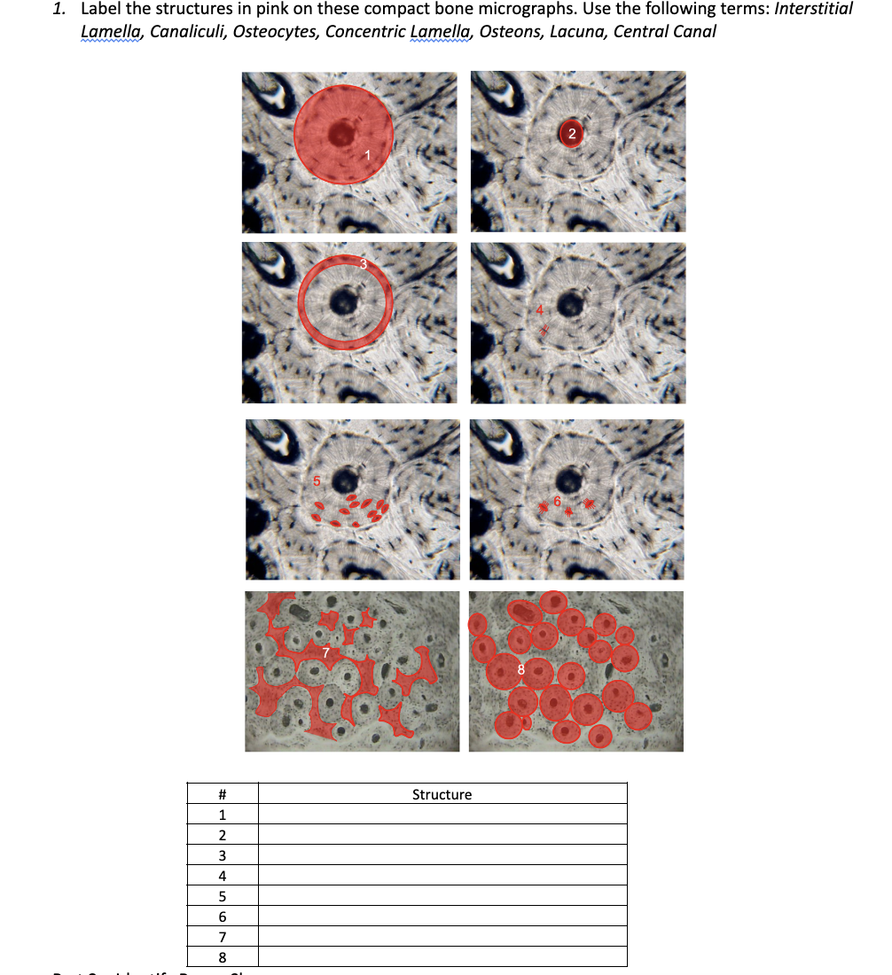 Solved 1. Label the structures in pink on these compact bone | Chegg.com