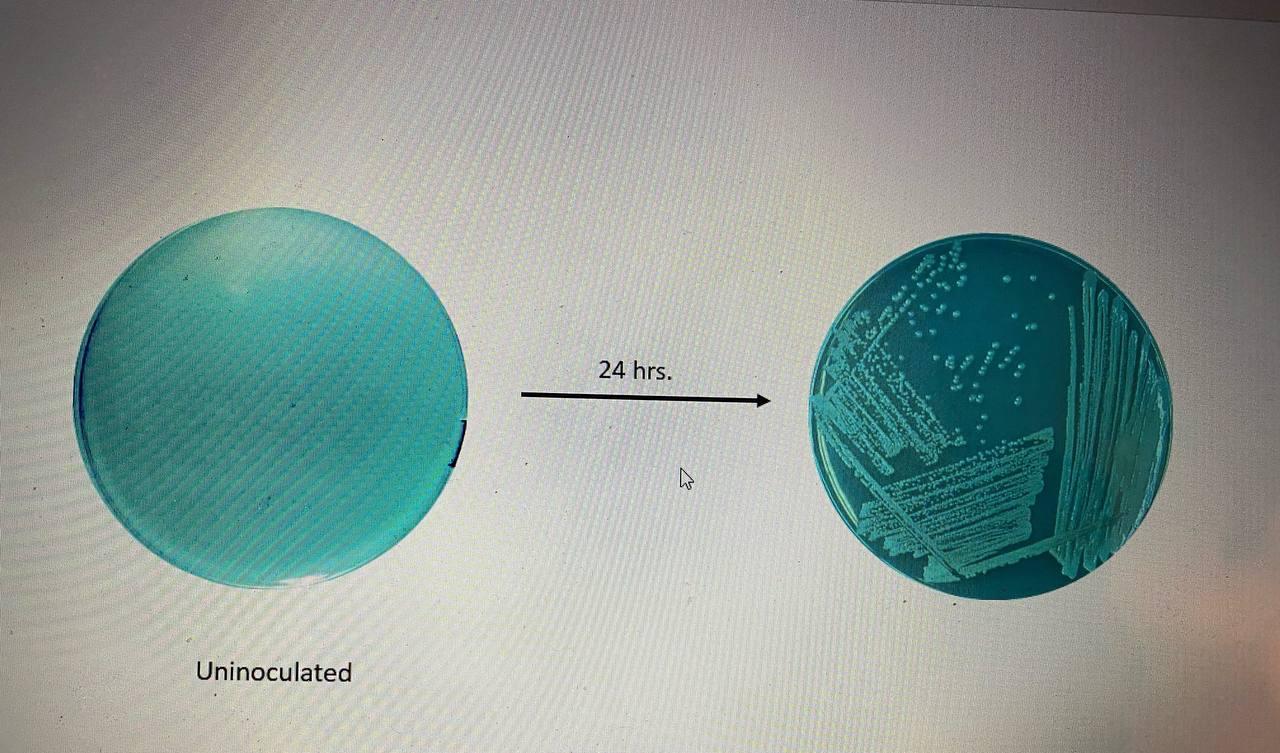 Solved determine the results of the DNase agar test below? | Chegg.com
