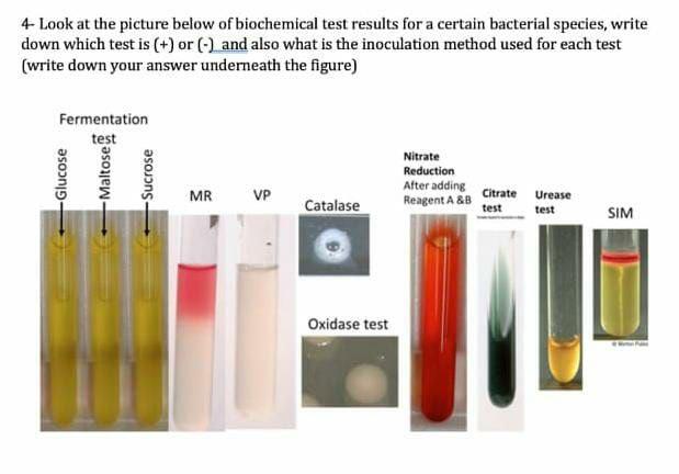 Solved 4- Look at the picture below of biochemical test | Chegg.com